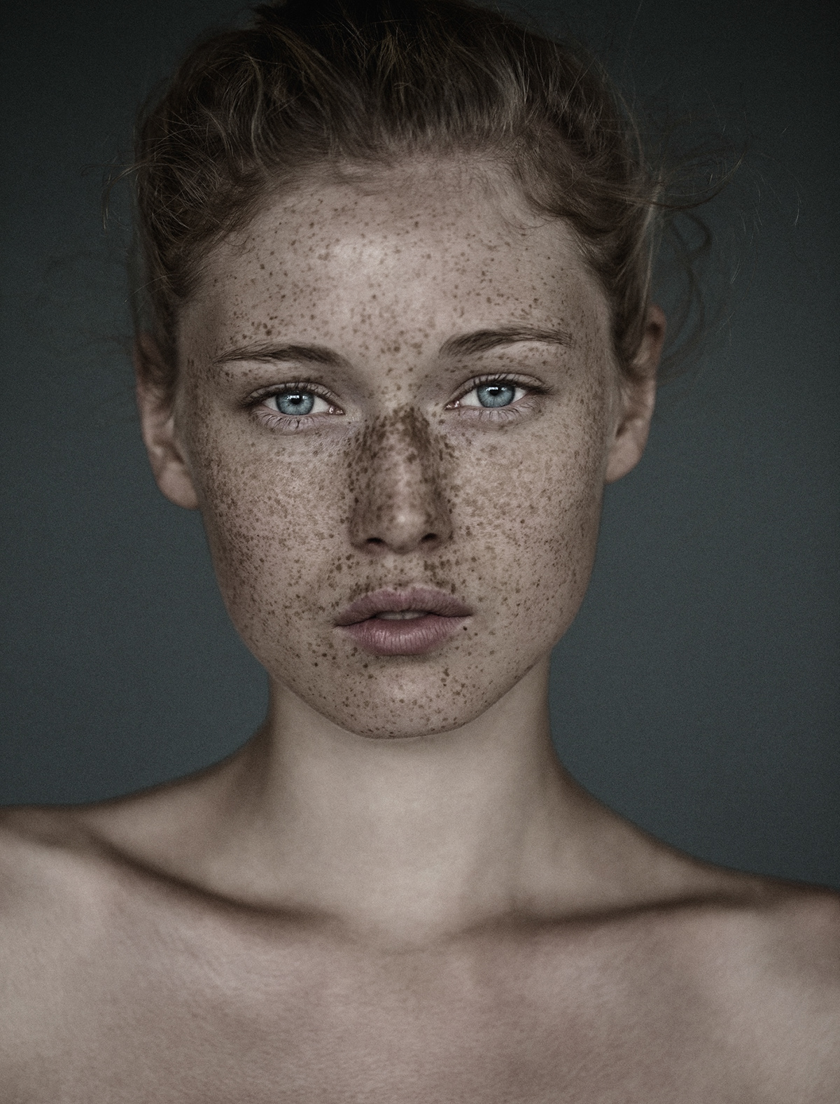 Carsten Witte - The Freckles Project