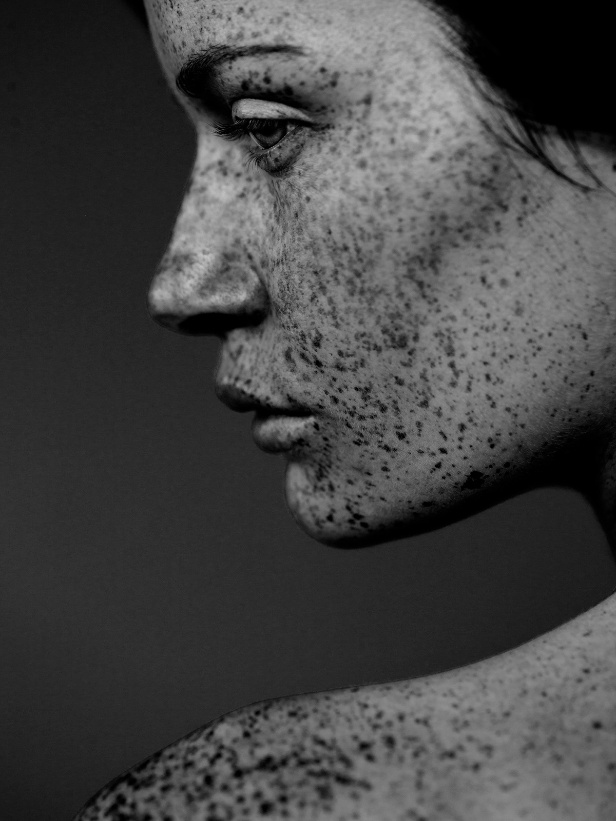 Carsten Witte - The Freckles Project