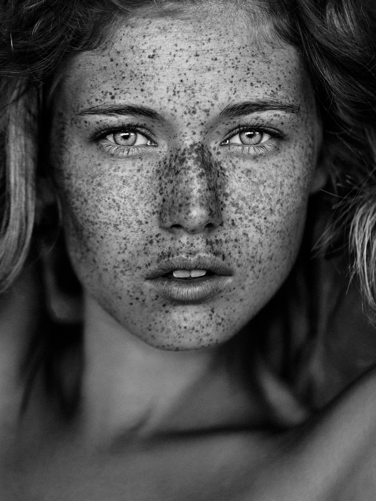 Carsten Witte - The Freckles Project