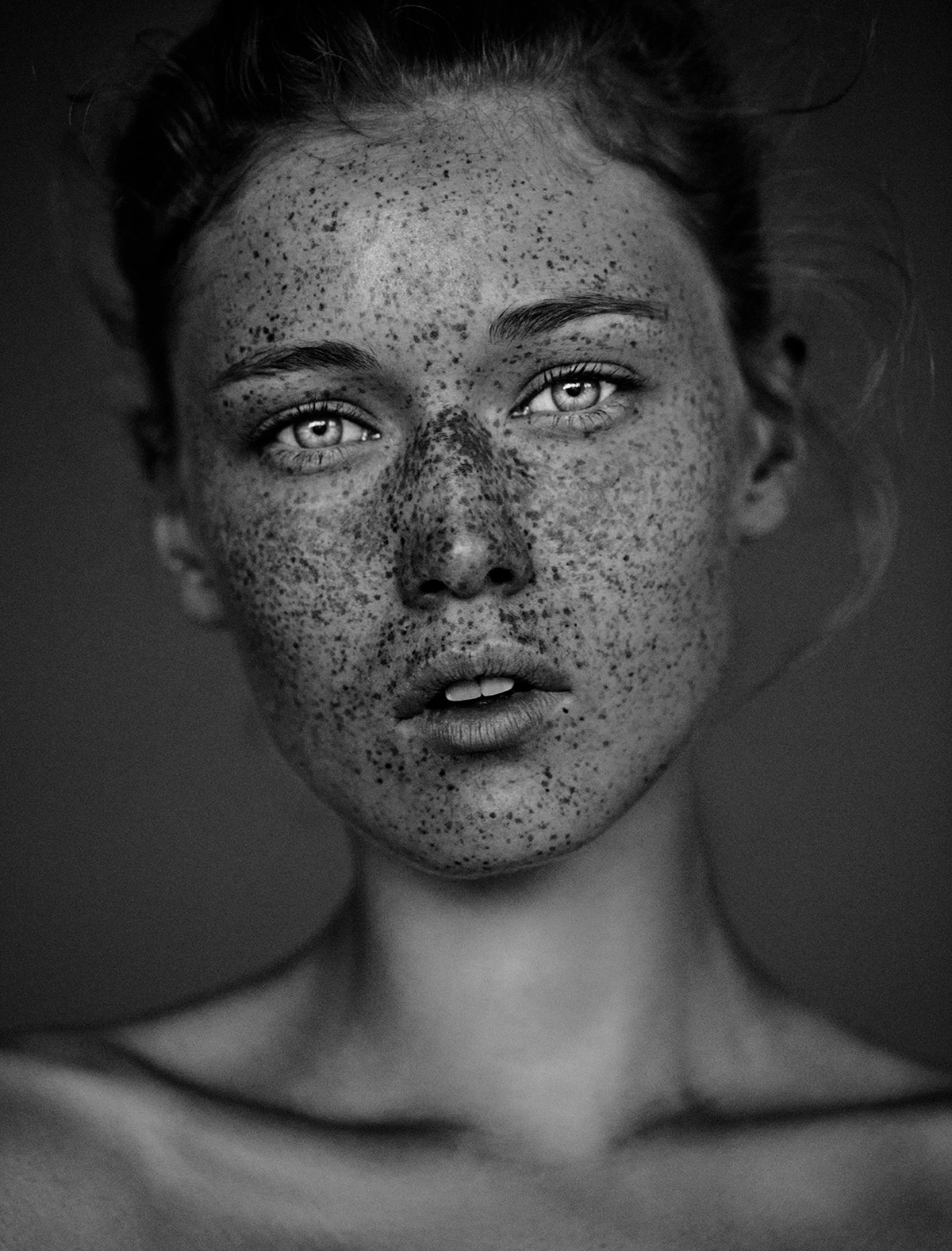 Carsten Witte - The Freckles Project