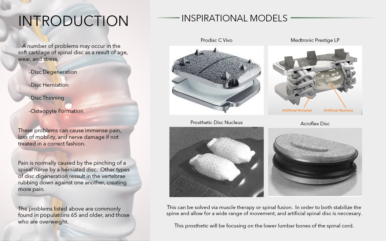 Patrick McMahon - SPINAL PROSTHETIC