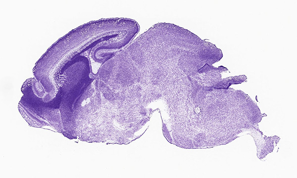 Parnian Bassir - Rat brain scan