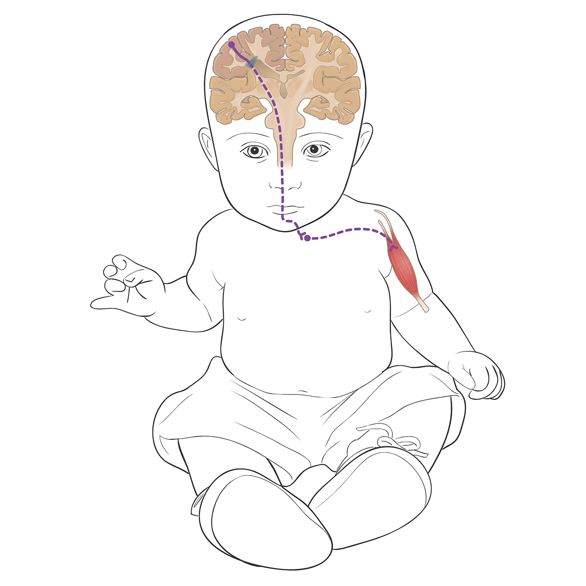 Teresa McLaren Medical and Scientific Illustration - Periventricular ...